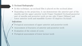 Radiography in conservative dentistry | PPTX