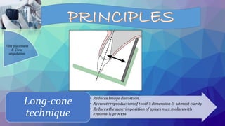 Radiography in endodontics | PPT