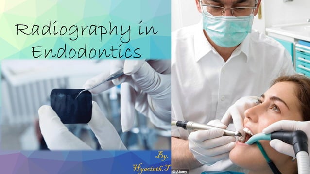 Radiography in endodontics | PPT