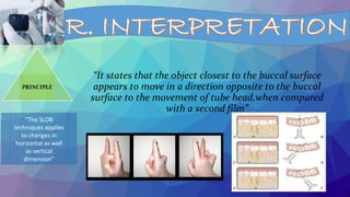 Radiography in endodontics | PPT