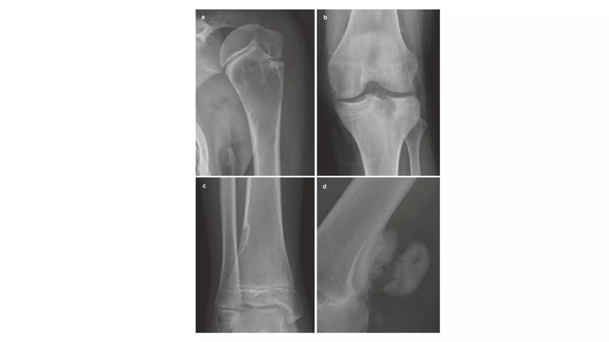 Approach to MSK tumor radiology.pptx