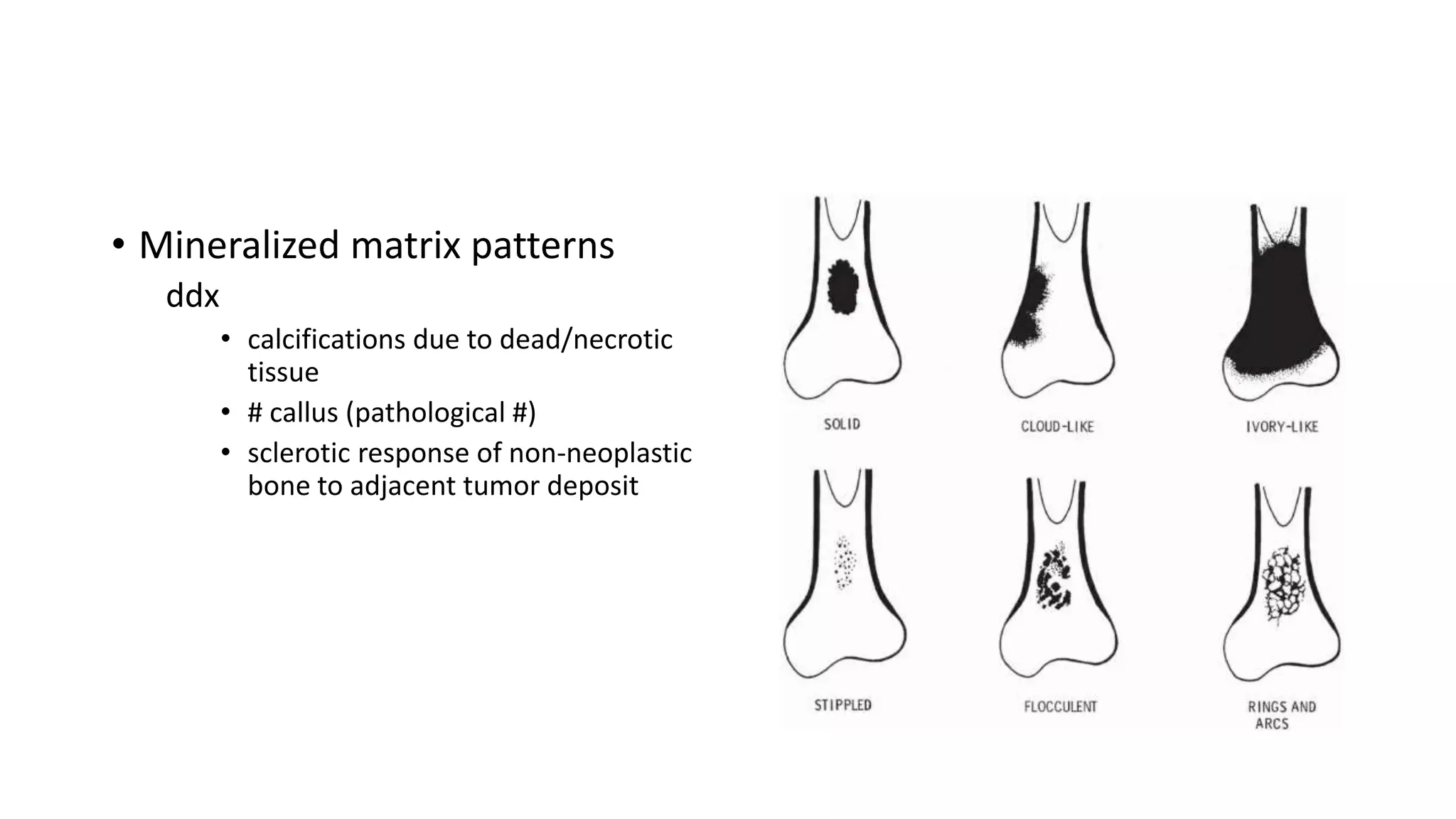 Approach to MSK tumor radiology.pptx