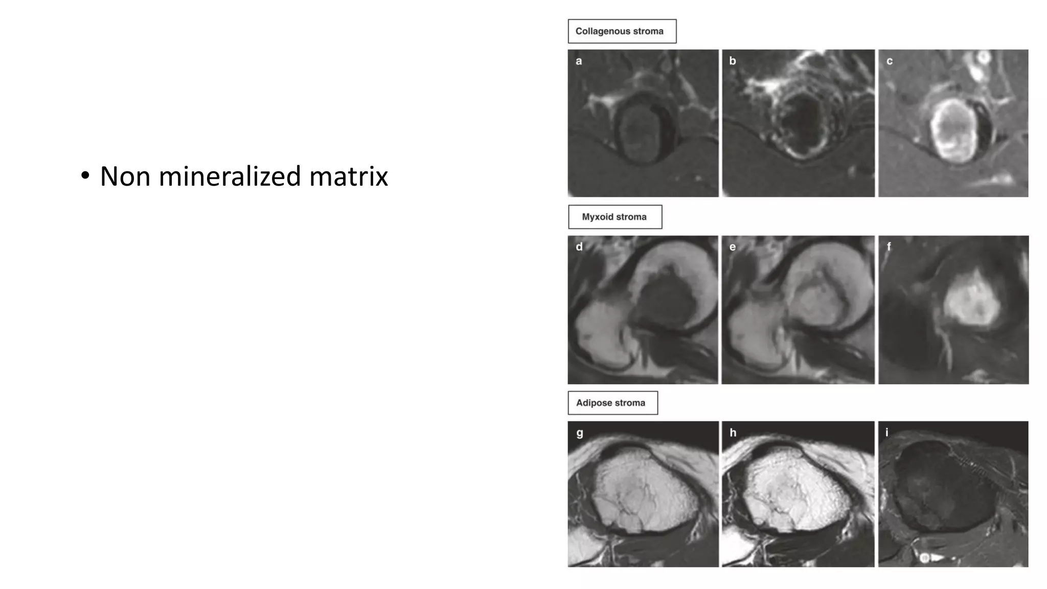Approach to MSK tumor radiology.pptx