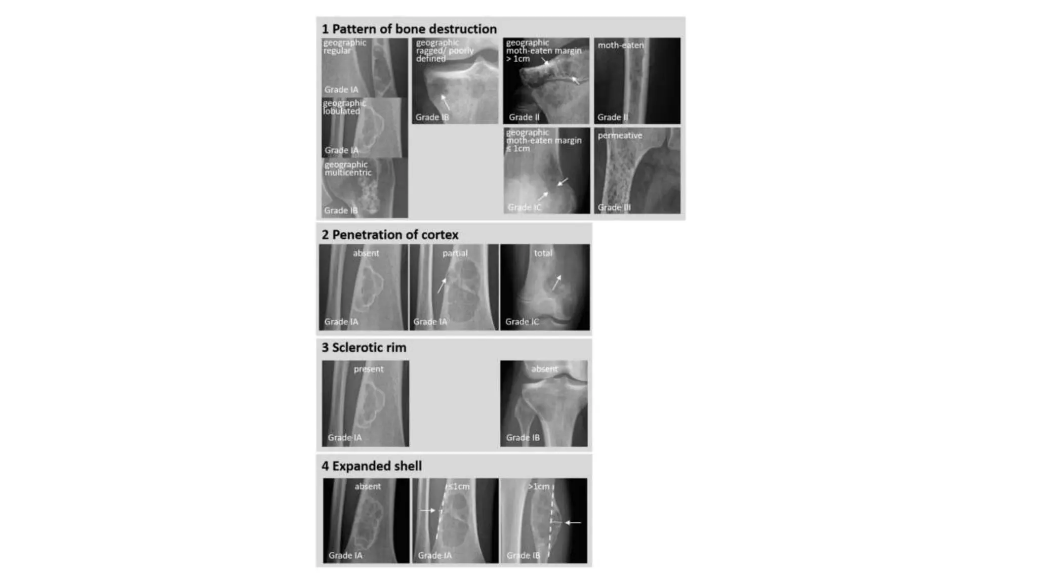 Approach to MSK tumor radiology.pptx
