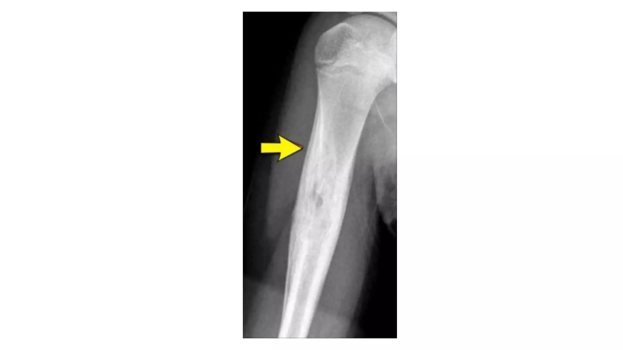 Approach to MSK tumor radiology.pptx