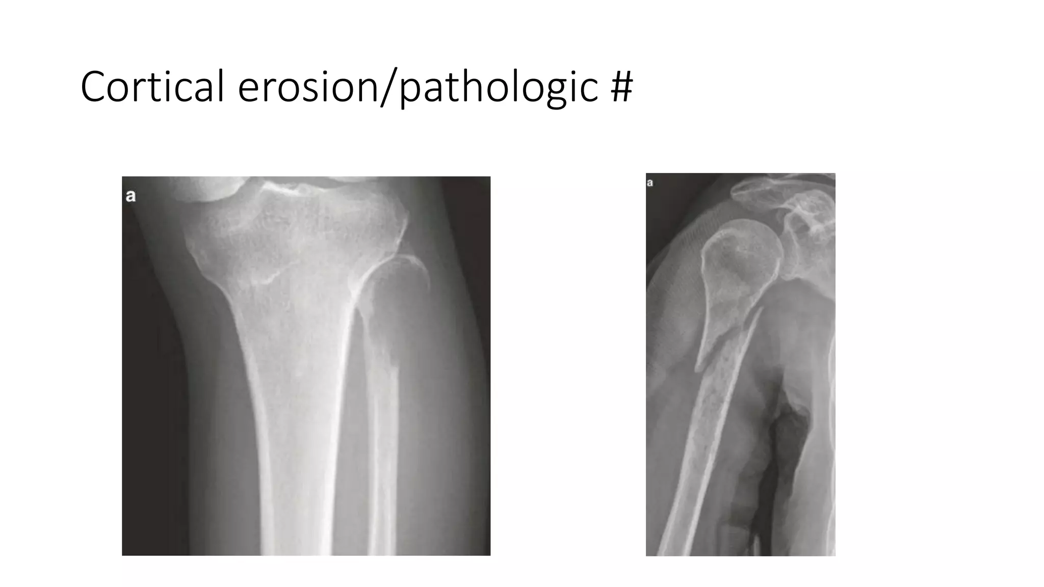 Approach to MSK tumor radiology.pptx