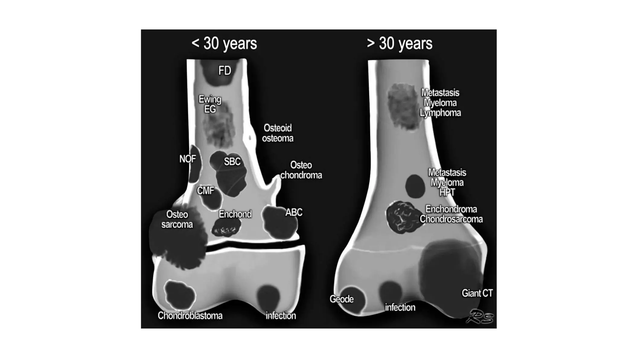 Approach to MSK tumor radiology.pptx