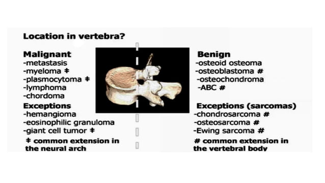 Approach to MSK tumor radiology.pptx | Bone and Joint Conditions ...
