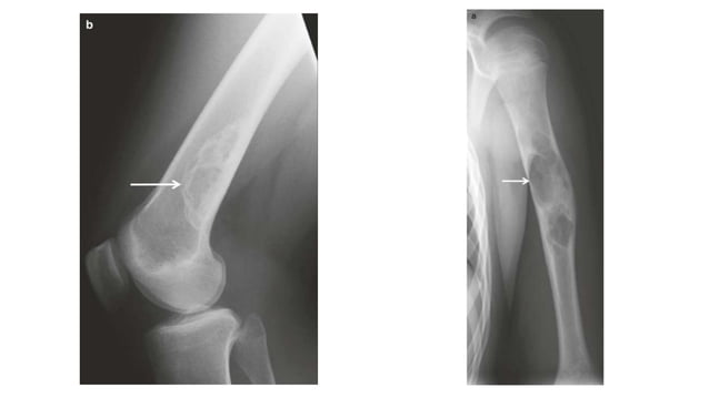 Approach to MSK tumor radiology.pptx | Bone and Joint Conditions ...