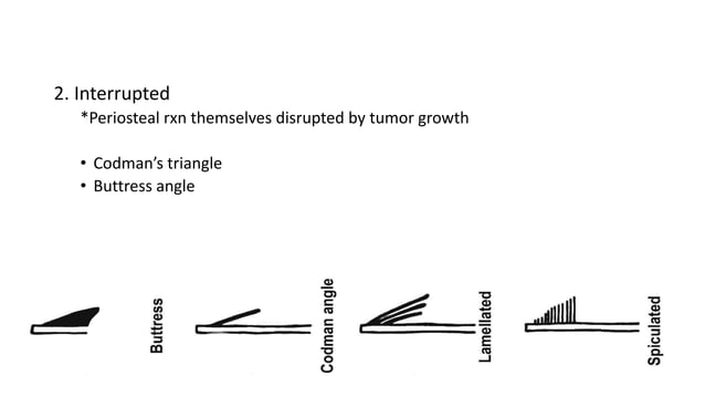 Approach to MSK tumor radiology.pptx | Bone and Joint Conditions ...