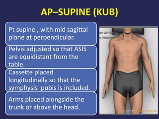 Radiography OF Abdomen -NISCHAL_NMC.pptx