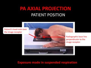Radiography of eye | PPTX