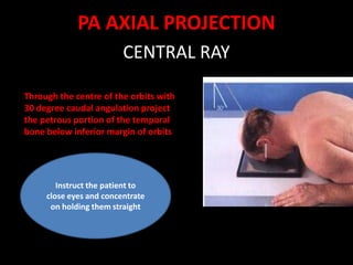 Radiography of eye | PPTX