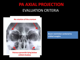 Radiography of eye | PPTX