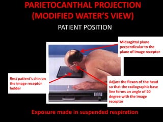 Radiography of eye | PPTX