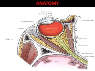 Radiography of eye | PPTX
