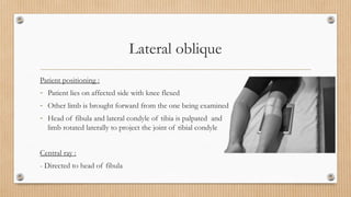 Presentation on the topic of RADIOGRAPHY OF LOWER LIMB | PPTX