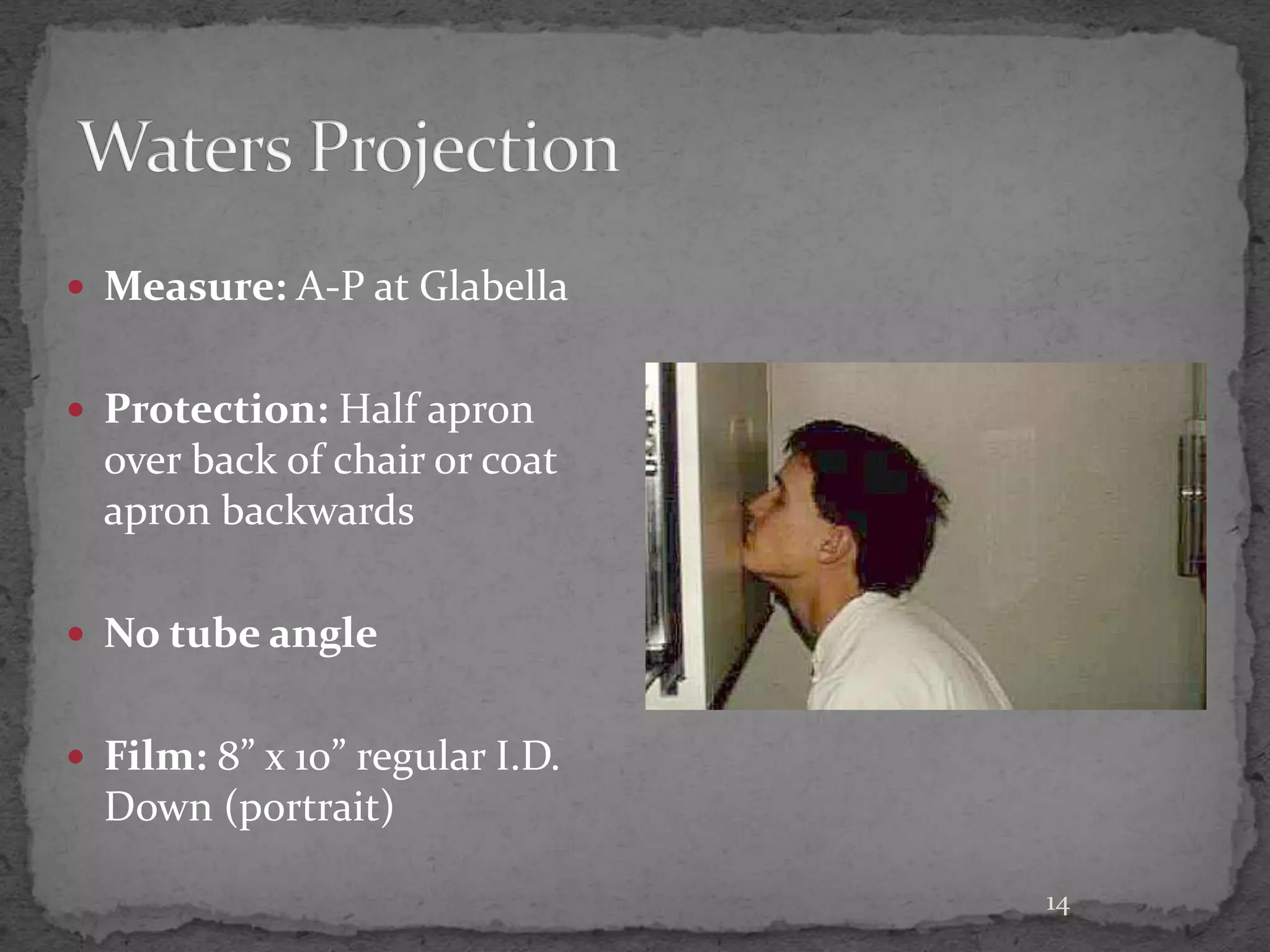 Radiography and Anatomy of orbit | PPTX