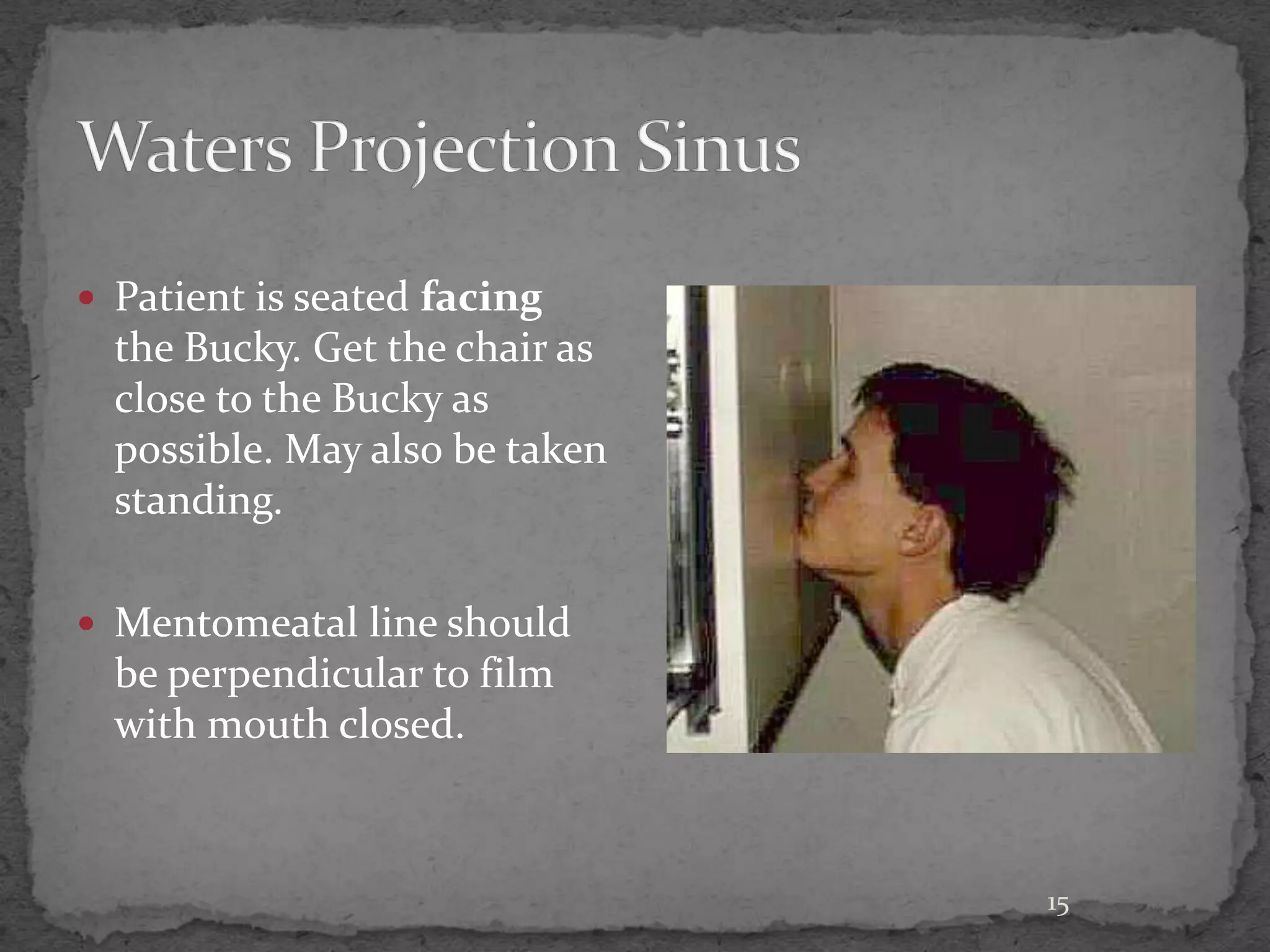 Radiography and Anatomy of orbit | PPTX