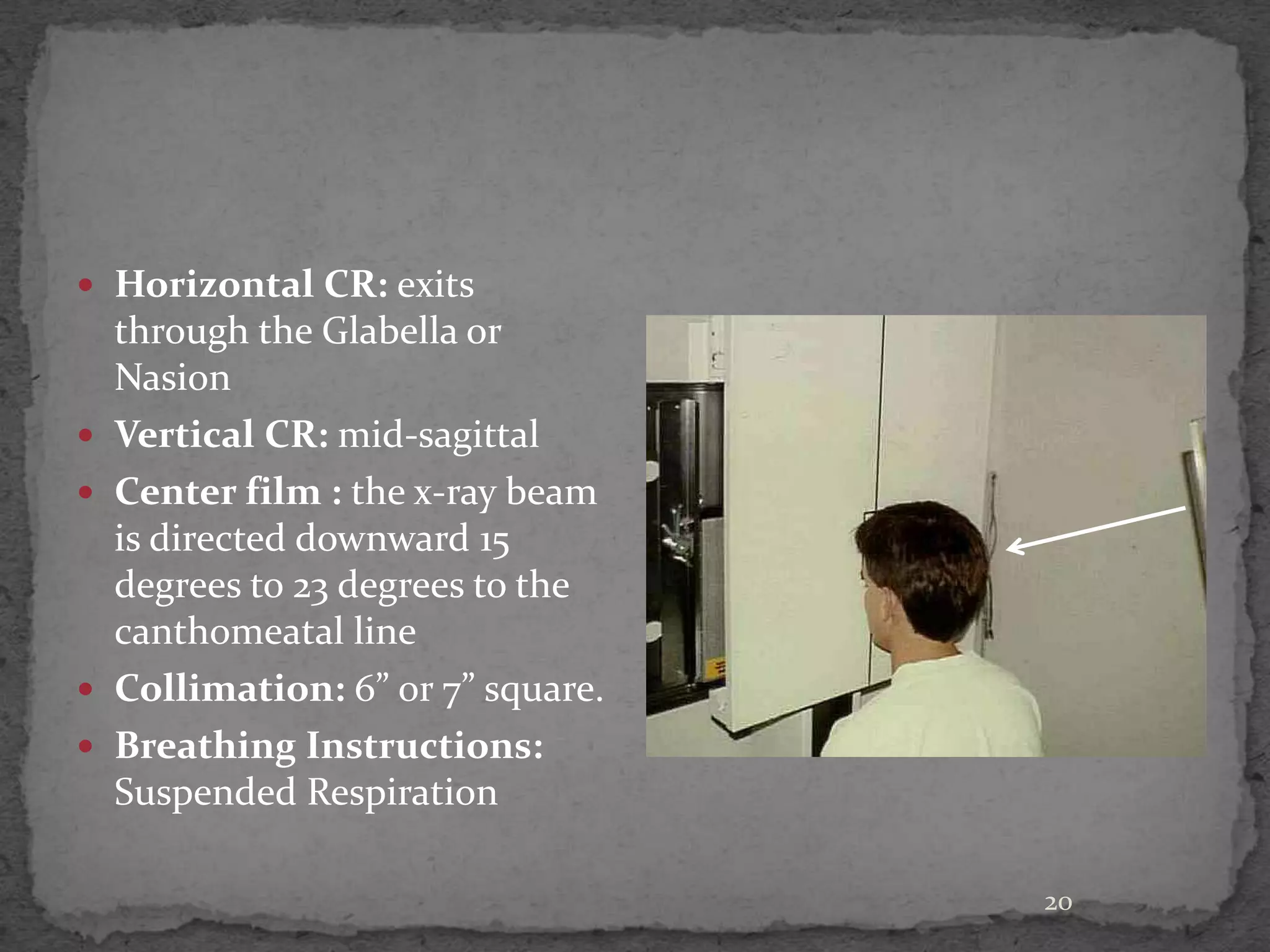 Radiography and Anatomy of orbit | PPTX