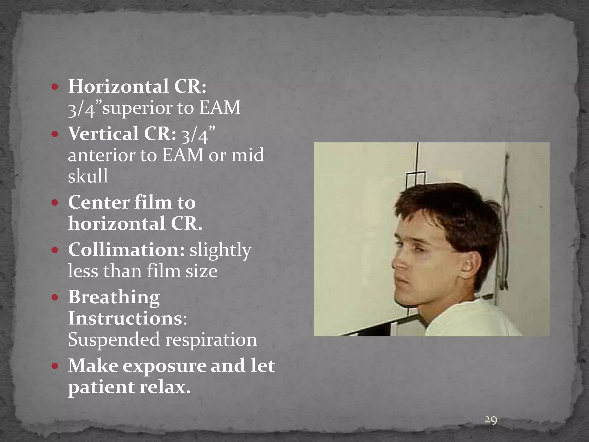 Radiography and Anatomy of orbit | PPTX