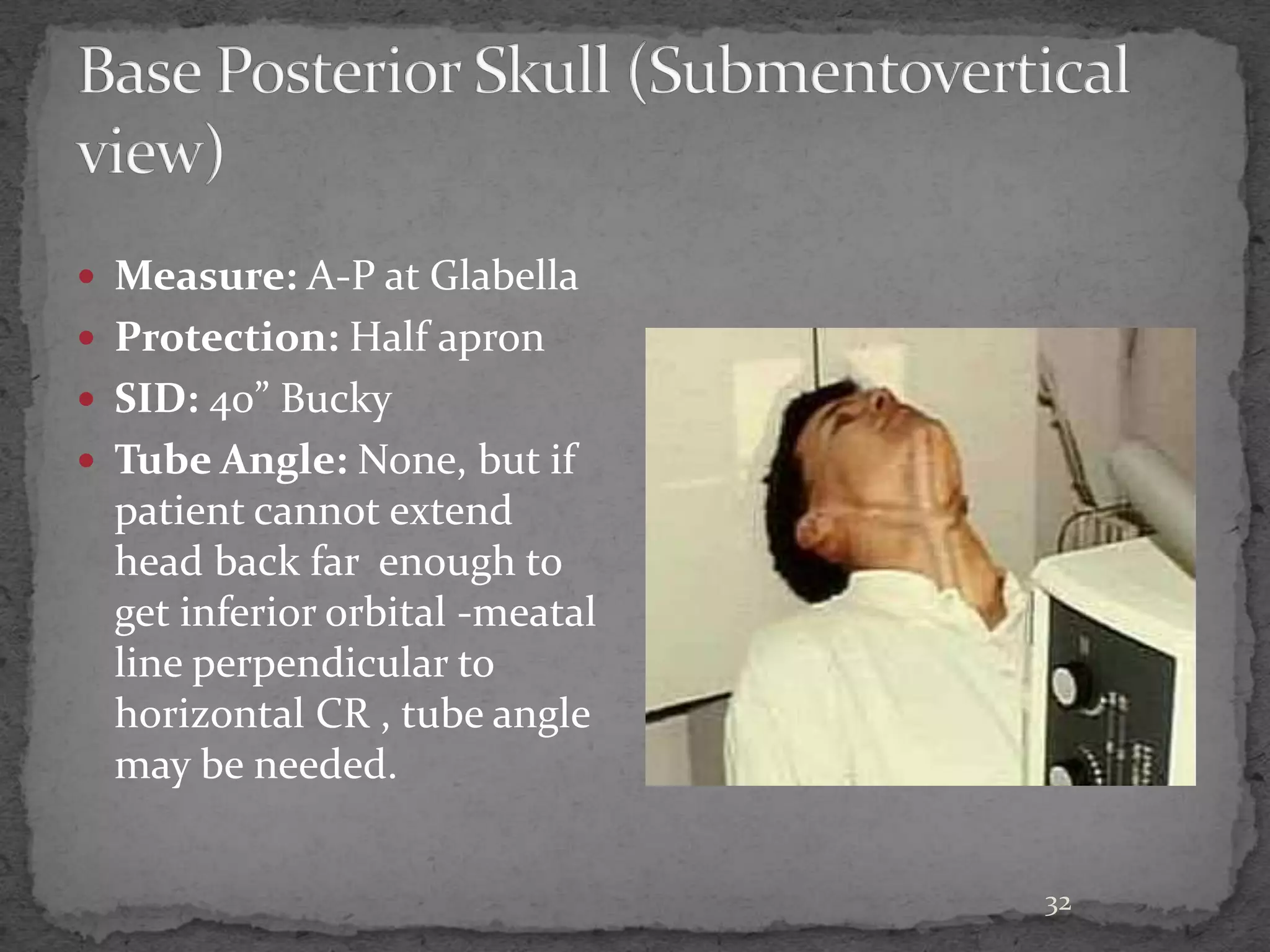 Radiography and Anatomy of orbit | PPTX