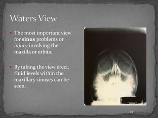 Radiography and Anatomy of orbit | PPTX