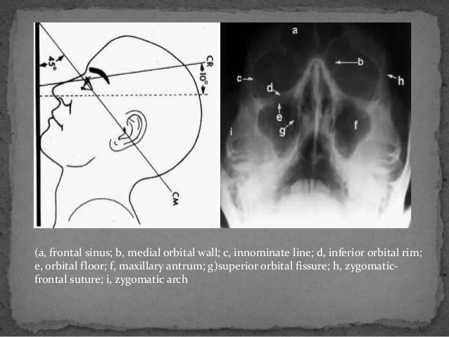 Radiography and Anatomy of orbit
