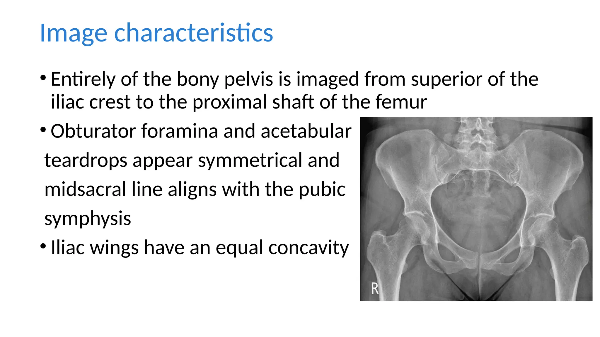RADIOGRAPHY OF PELVIS AND HIPJOINTS.pptx
