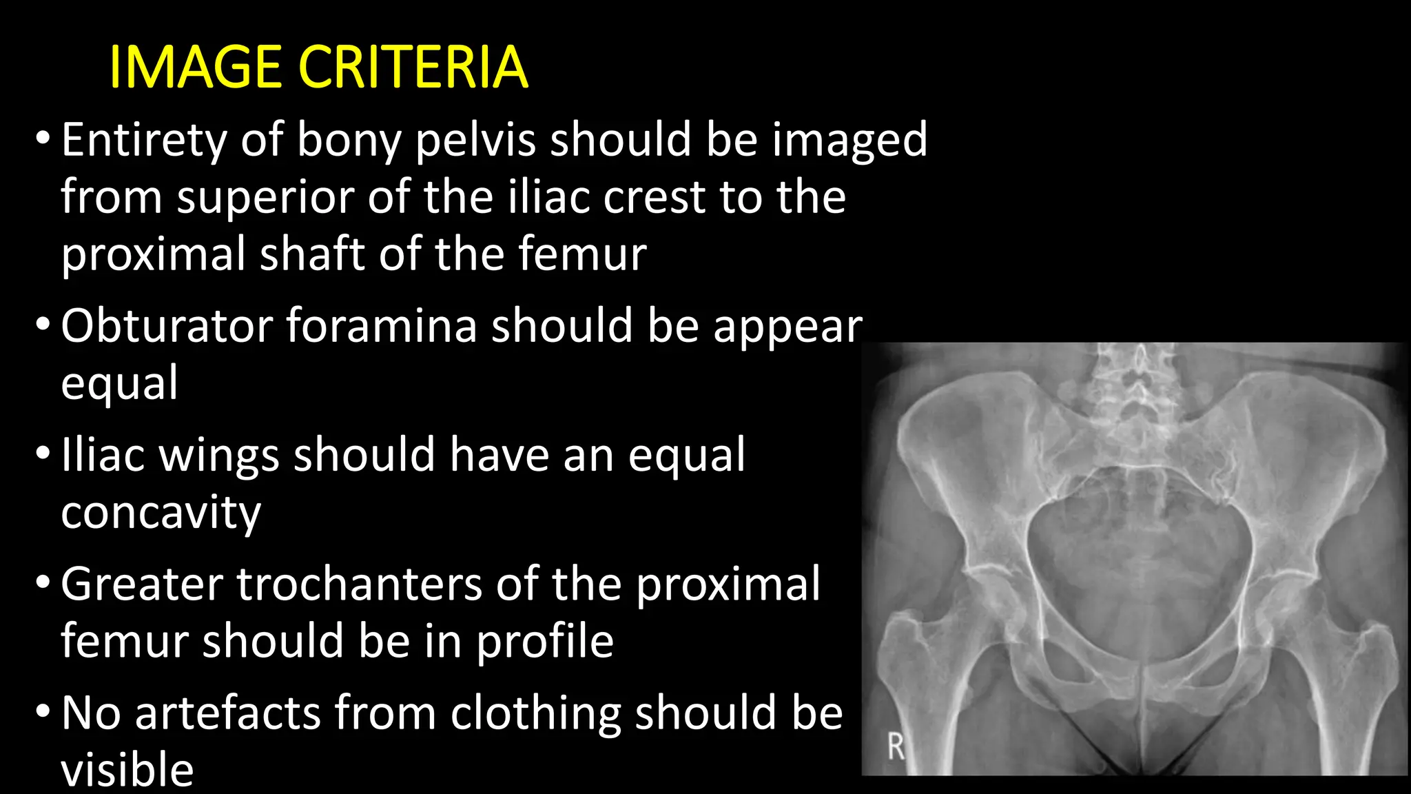 Radiography of Pelvis & Hip Joints - Saroj.pptx