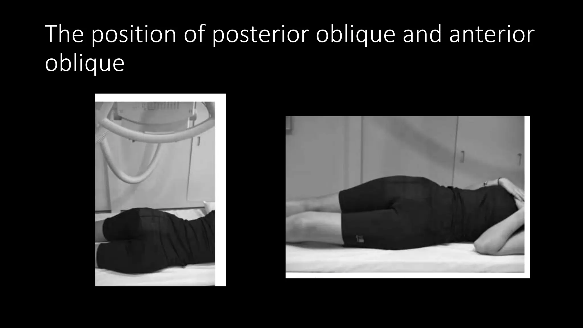 Radiography of Pelvis & Hip Joints - Saroj.pptx