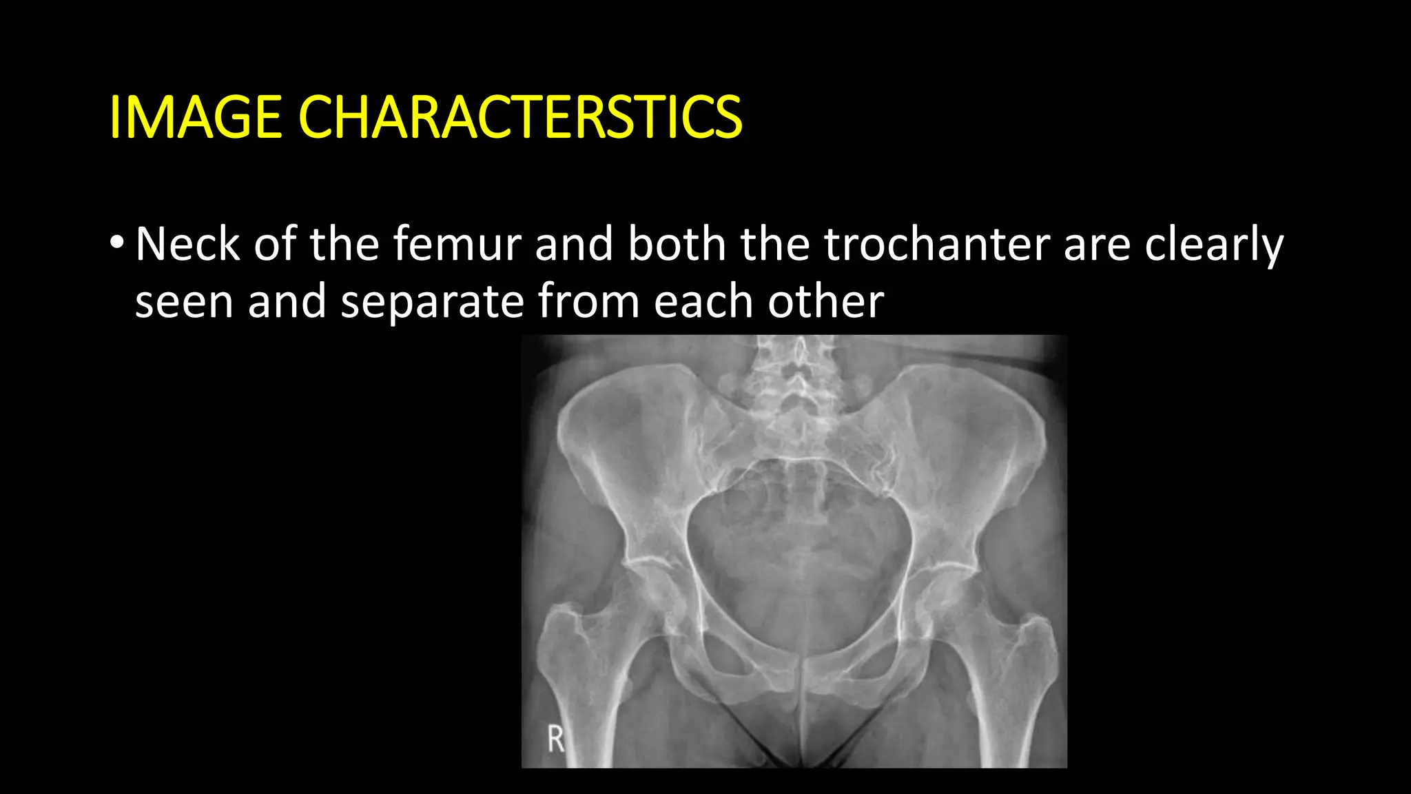 Radiography of Pelvis & Hip Joints - Saroj.pptx