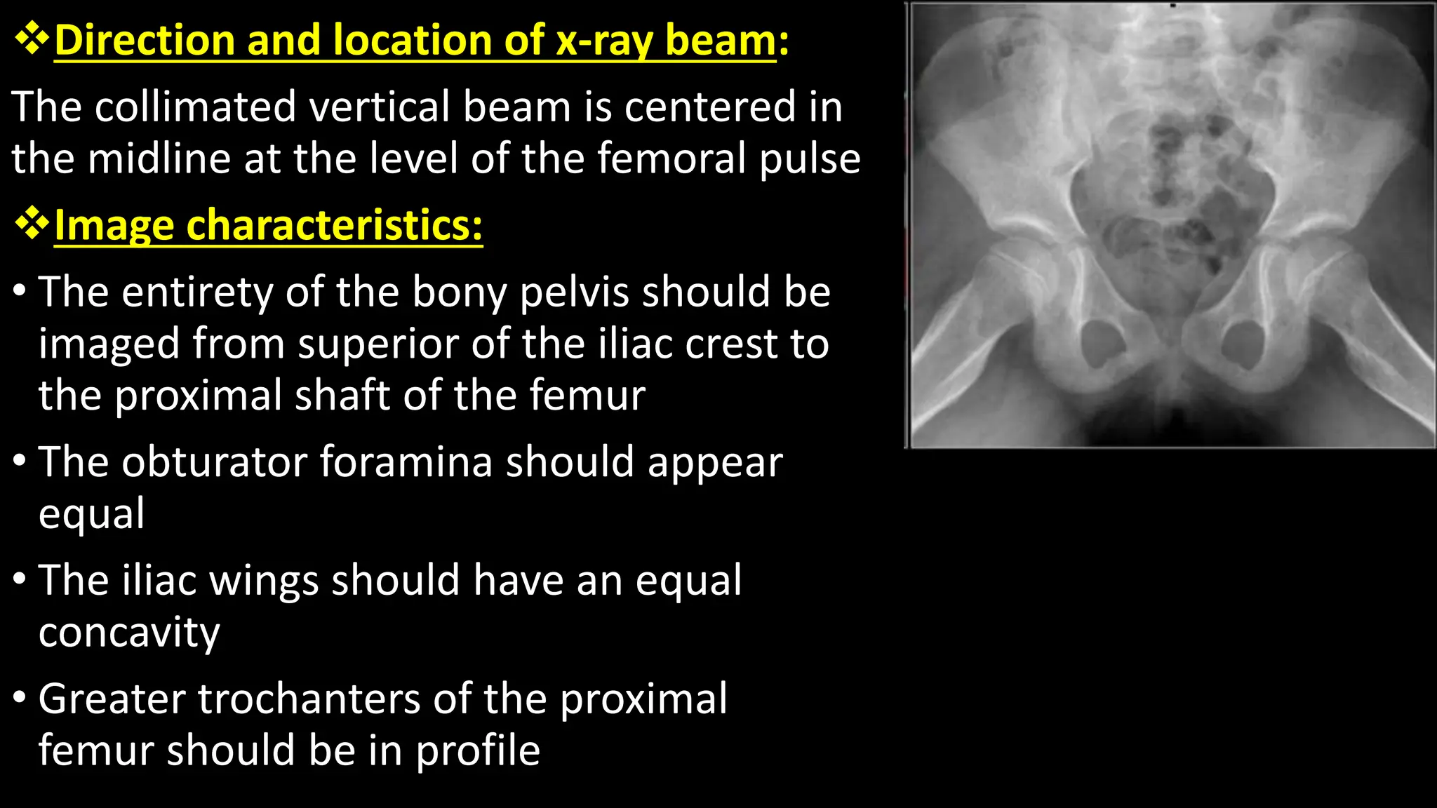 Radiography of Pelvis & Hip Joints - Saroj.pptx