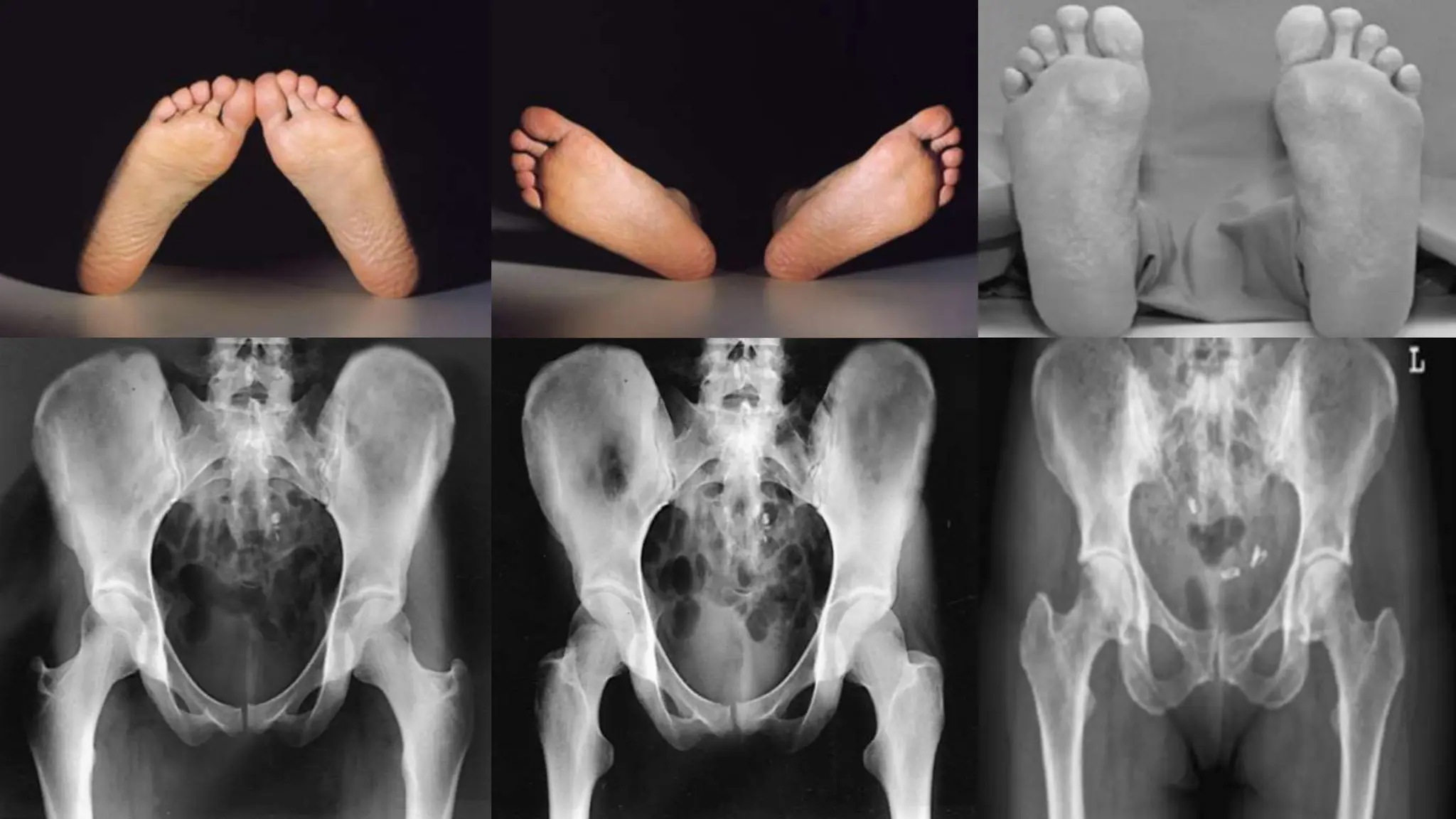Radiography of Pelvis & Hip Joints - Saroj.pptx