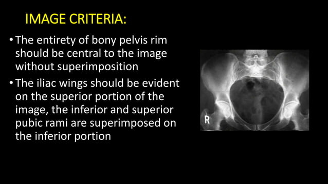Radiography of Pelvis & Hip Joints - Saroj.pptx