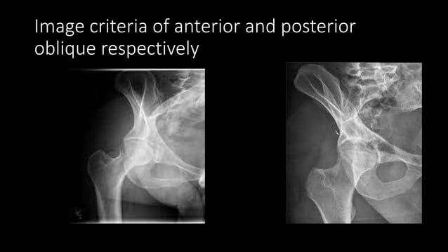Radiography of Pelvis & Hip Joints - Saroj.pptx