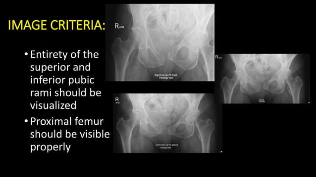 Radiography of Pelvis & Hip Joints - Saroj.pptx