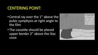 Radiography of Pelvis & Hip Joints - Saroj.pptx