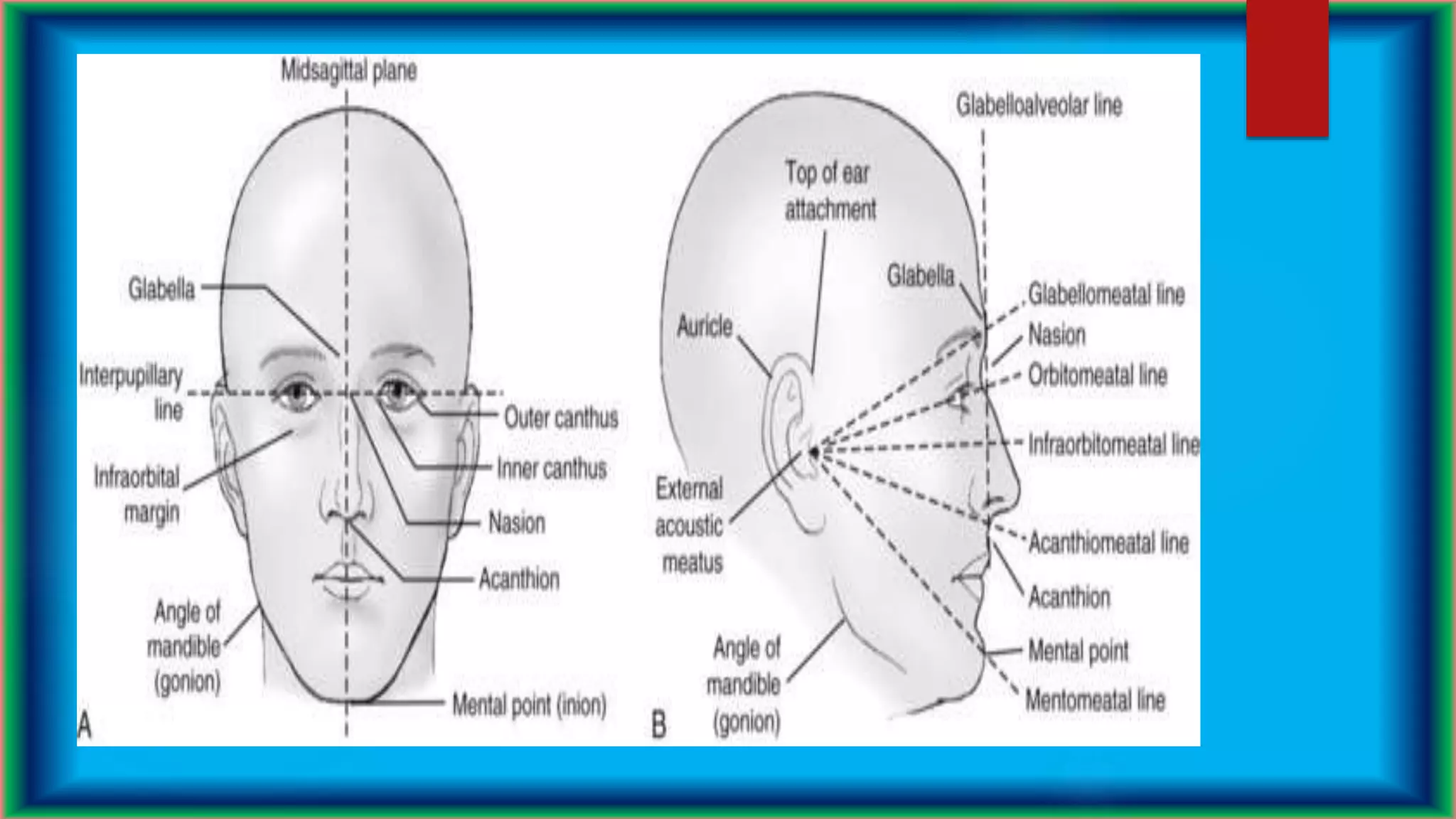 radiography of PNS.pptx