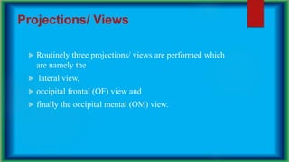 radiography of PNS.pptx