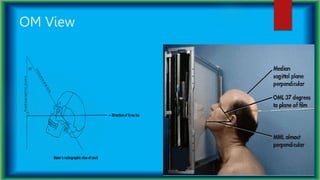 radiography of PNS.pptx