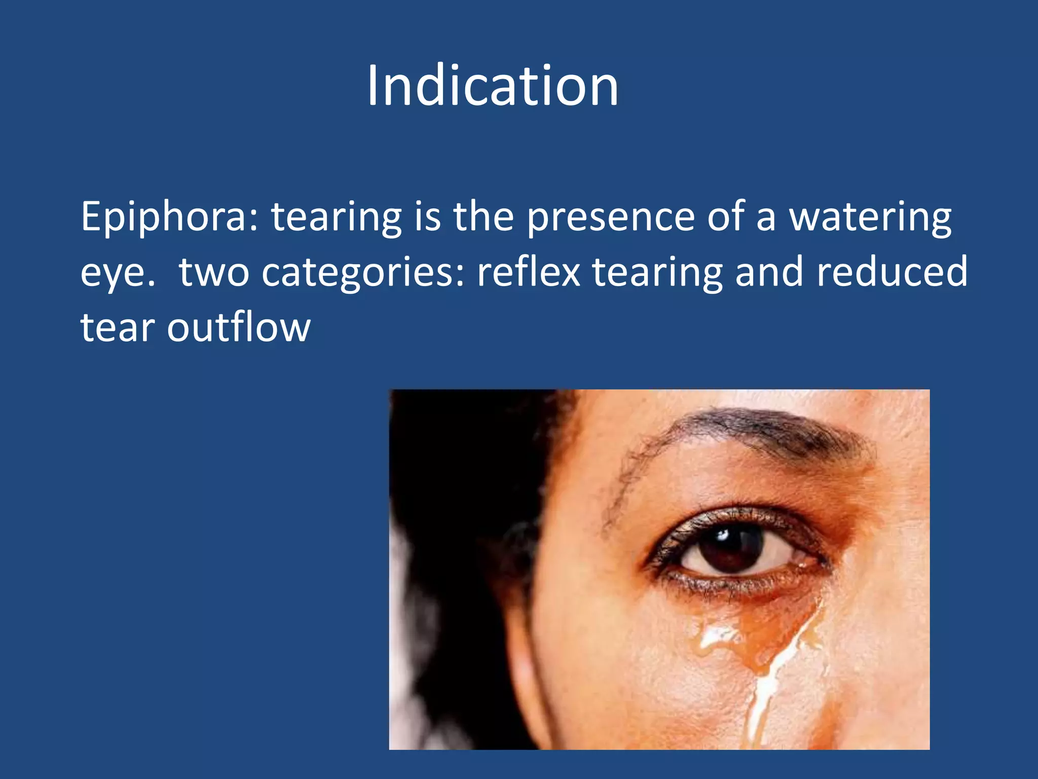 Radiography round on dacrocystography | PPTX
