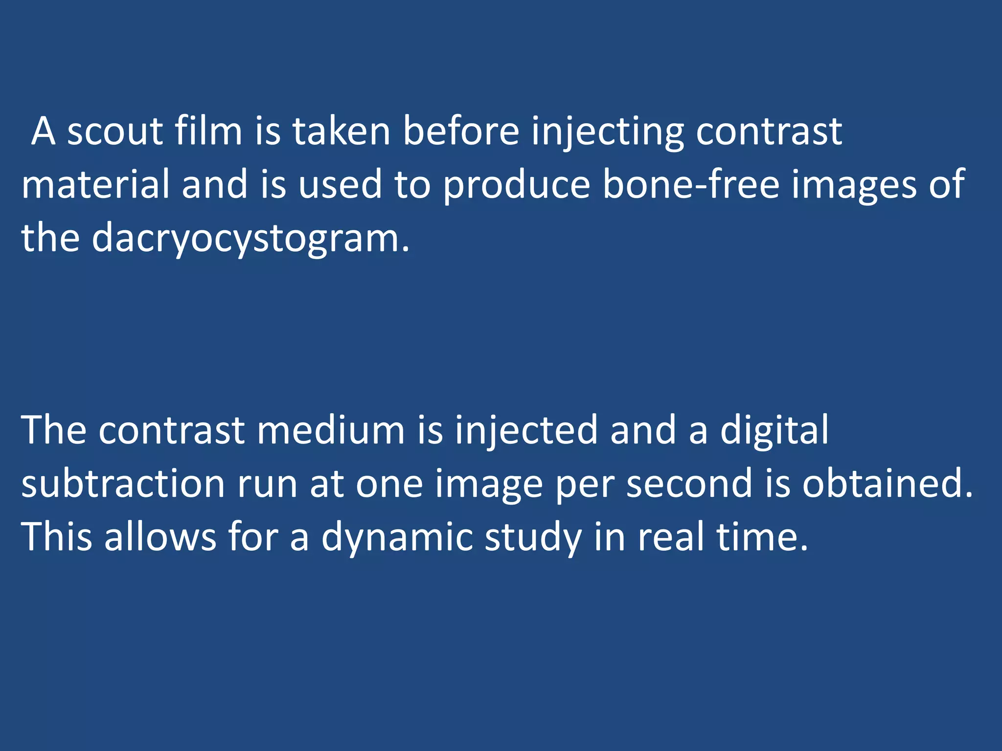 Radiography round on dacrocystography | PPTX