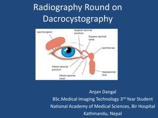 Radiography round on dacrocystography | PPTX