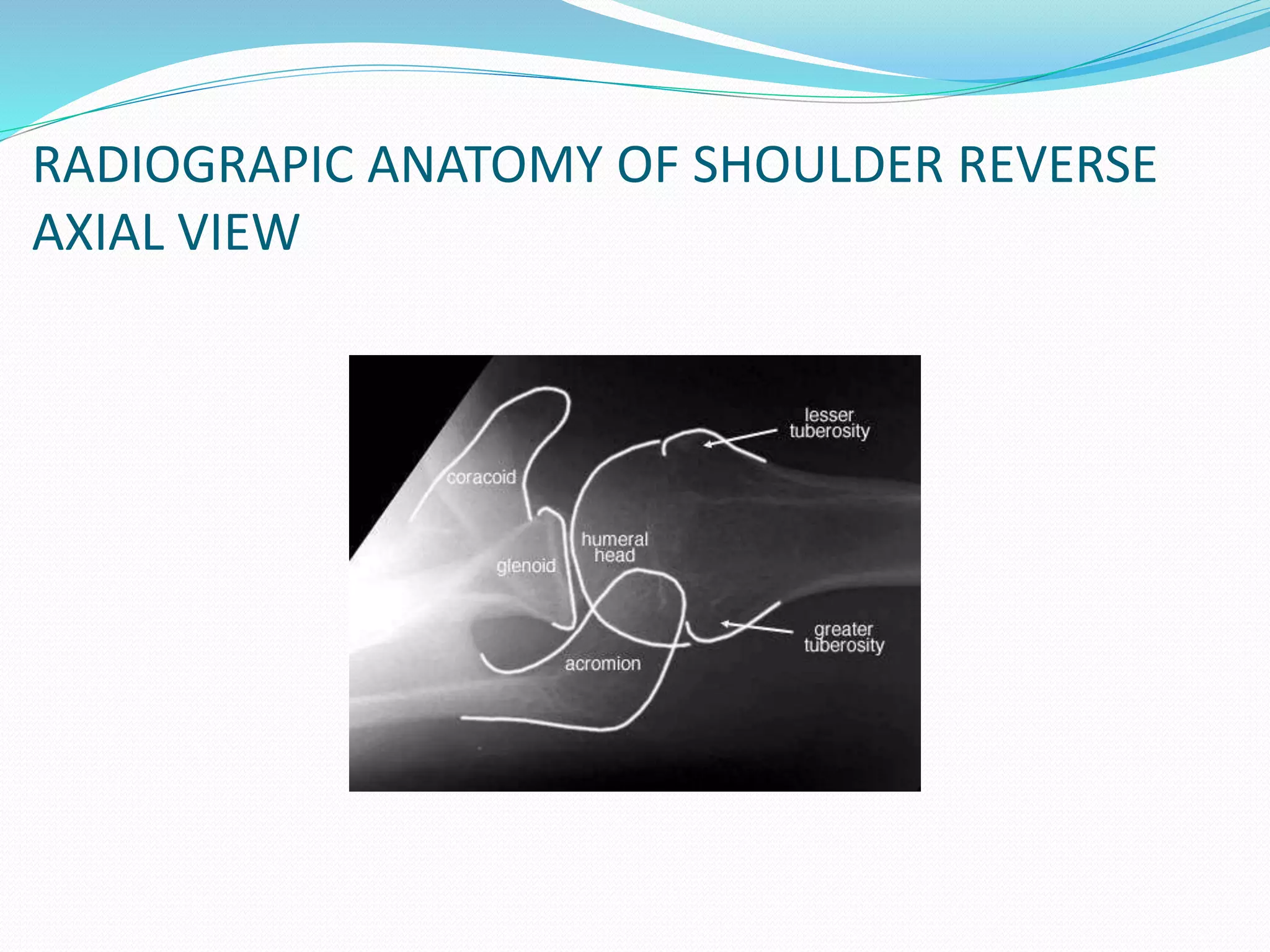 Radiograpic views for shoulder joint | PPTX
