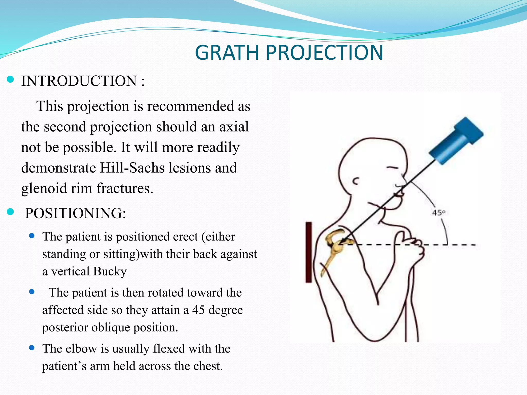 Radiograpic views for shoulder joint | PPTX