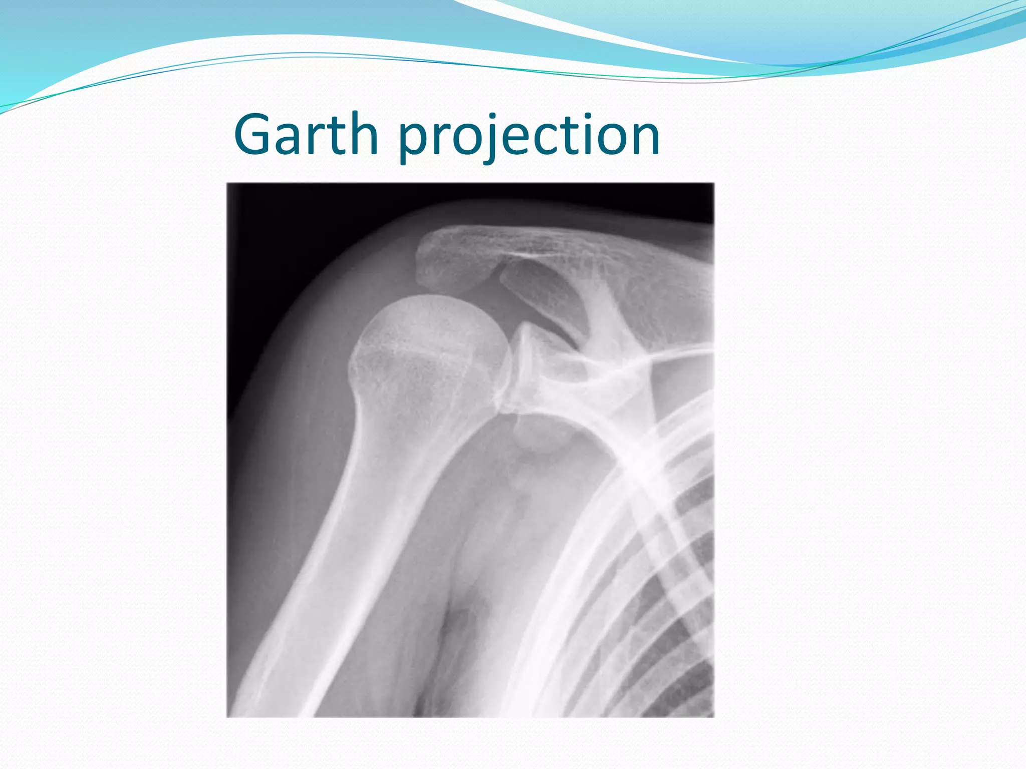 Radiograpic views for shoulder joint | PPTX