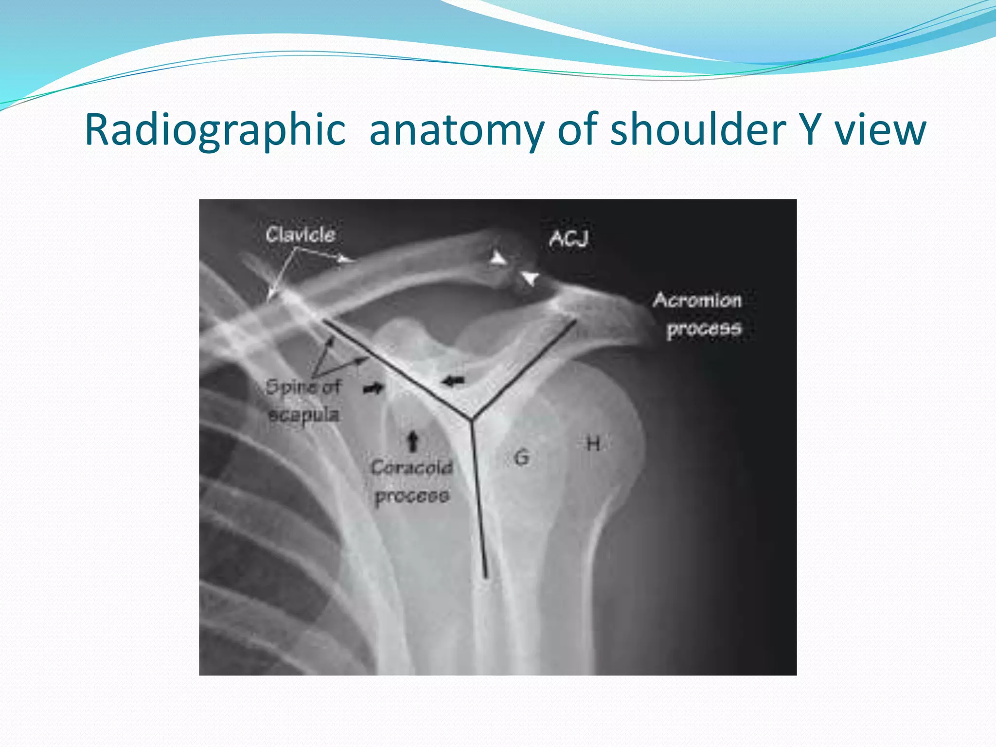 Radiograpic views for shoulder joint | PPTX