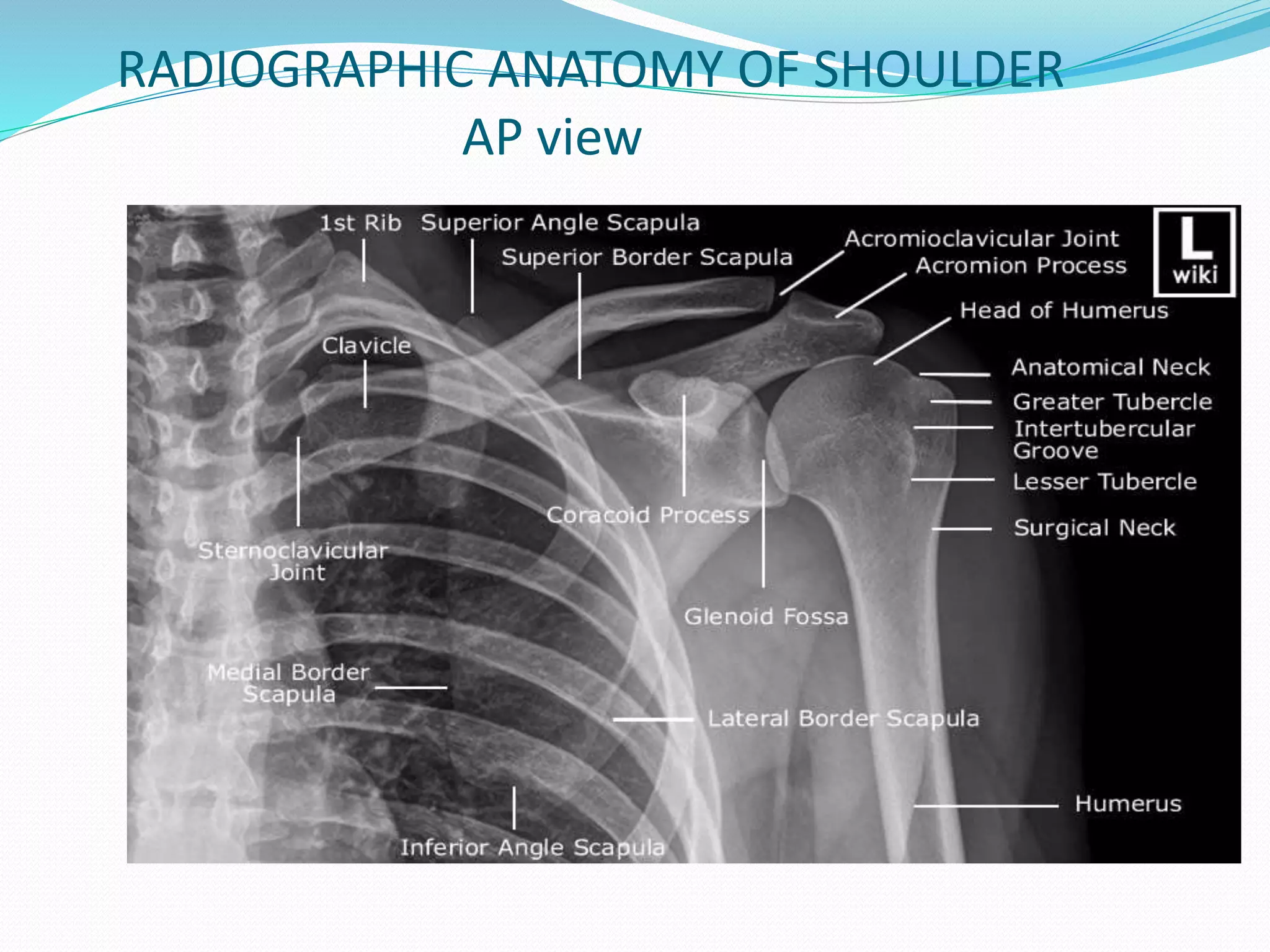 Radiograpic views for shoulder joint | PPTX