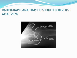 Radiograpic views for shoulder joint | PPTX